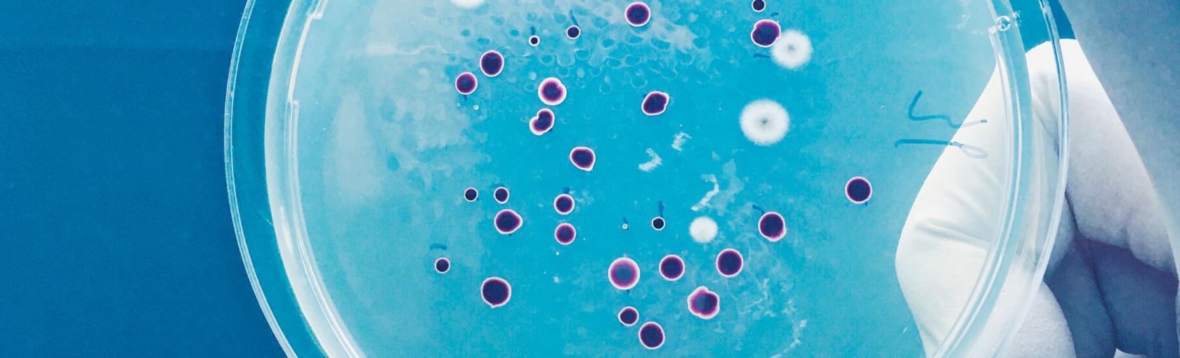 Focus sur les IST bactériennes et parasitaires : syphilis, gonococcie ...